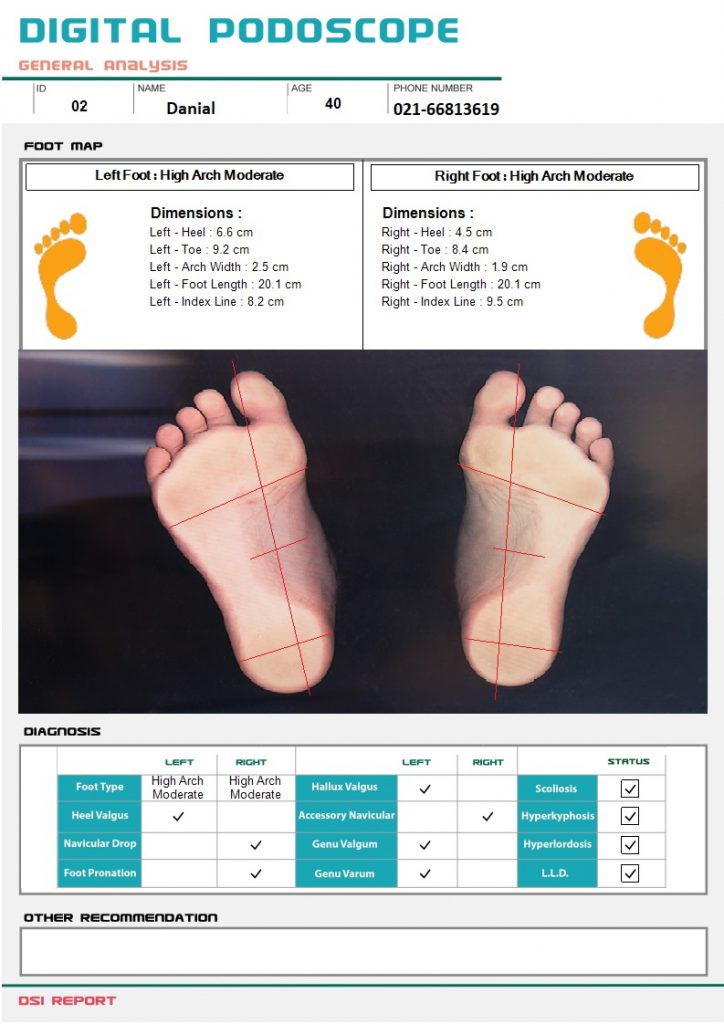 Camera Featured Podoscope + Software - دسی‌کالا