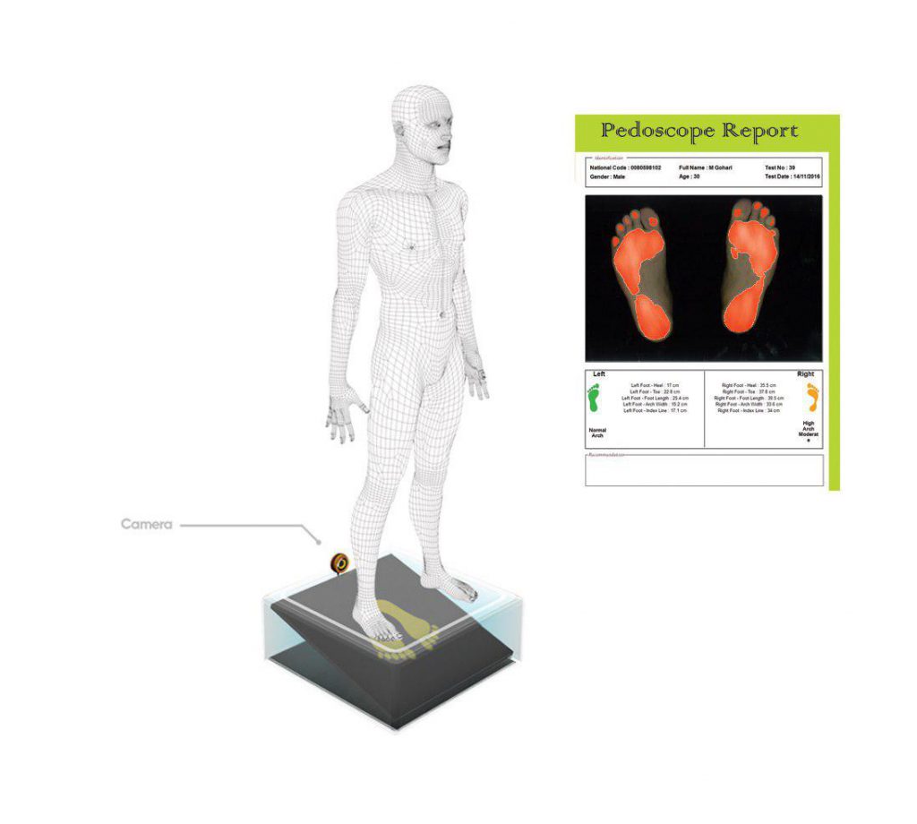Camera Featured Podoscope + Software - دسی‌کالا