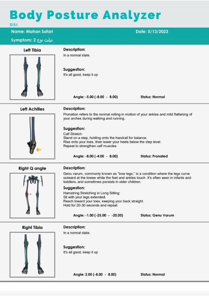 Body Posture Analyzer - دسی‌کالا