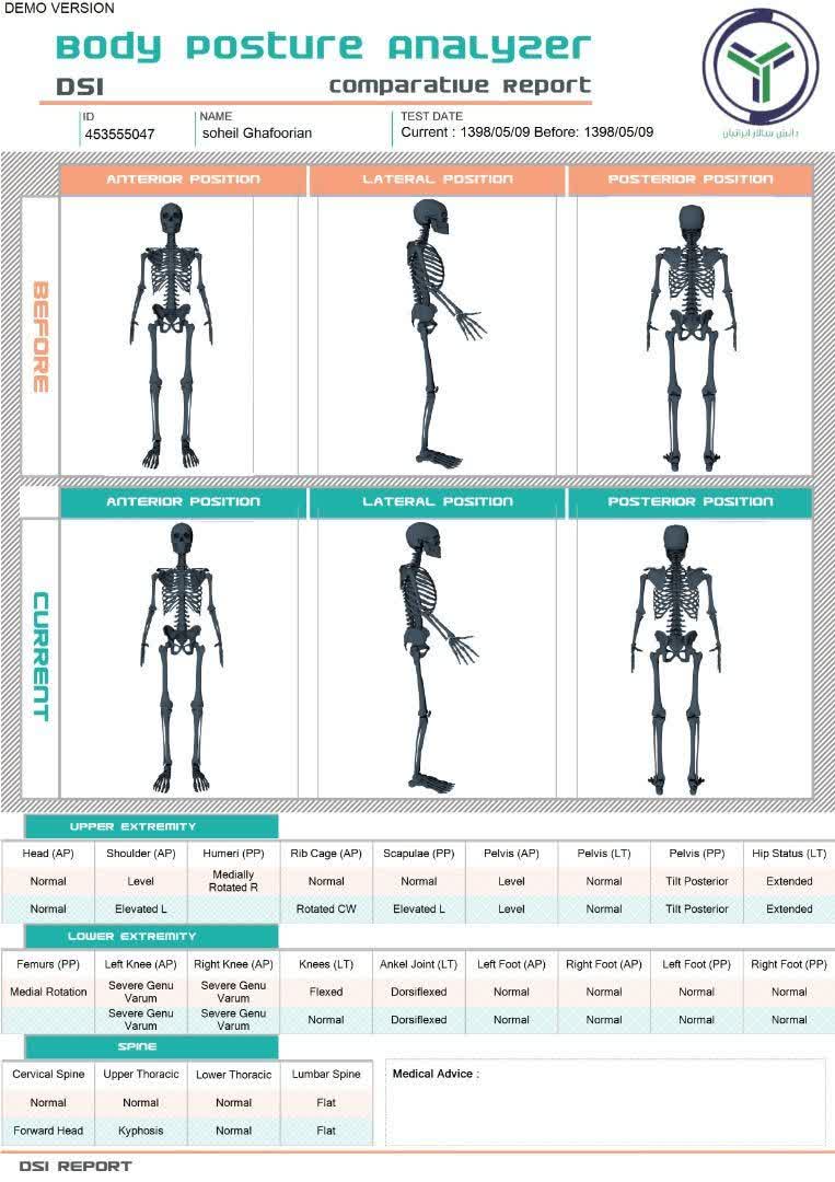 Body Posture Analyzer - دسی‌کالا